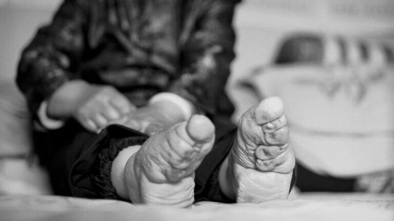 Legarea picioarelor. Ritualul din China care a torturat miliarde de femei